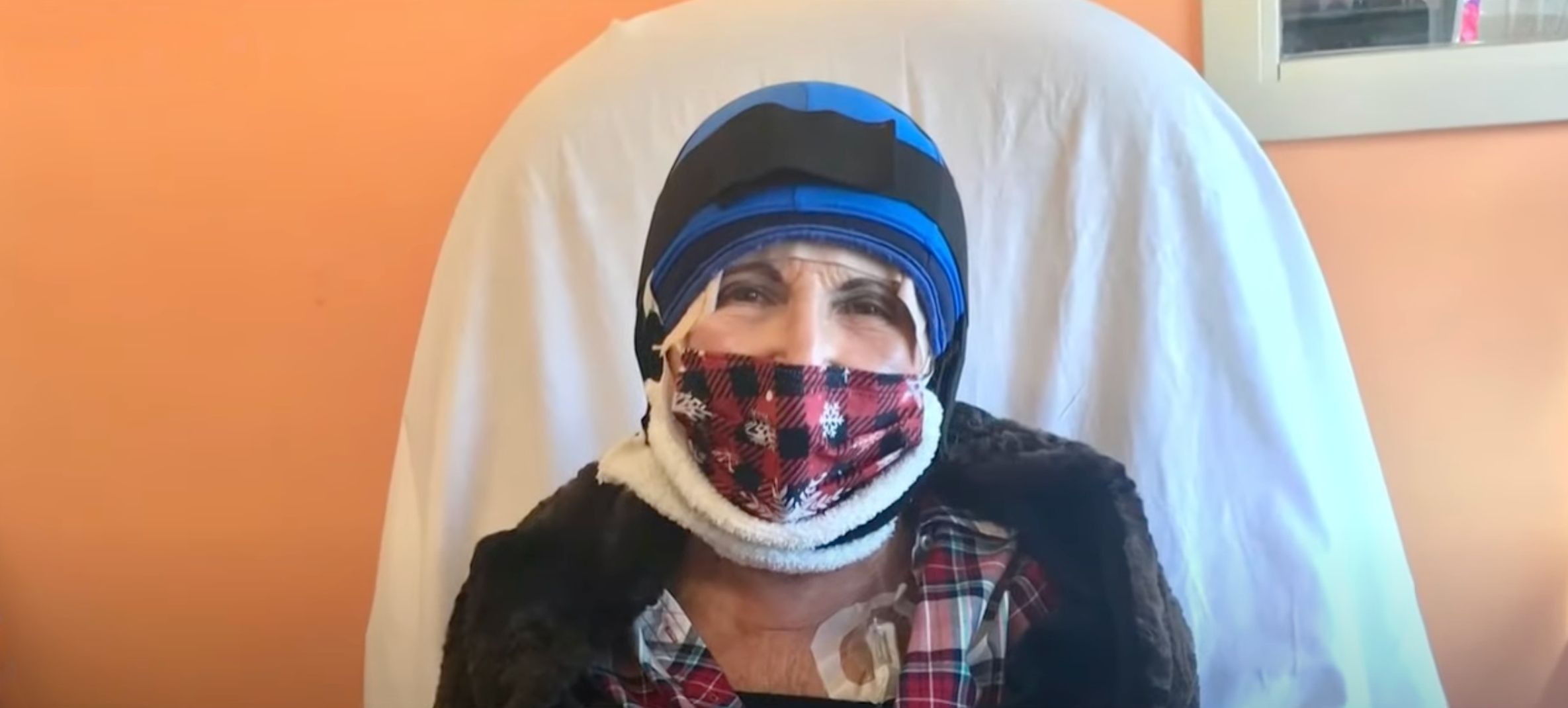 Cold Caps & Scalp Cooling Therapy: A Breakthrough for Cancer Patients ...